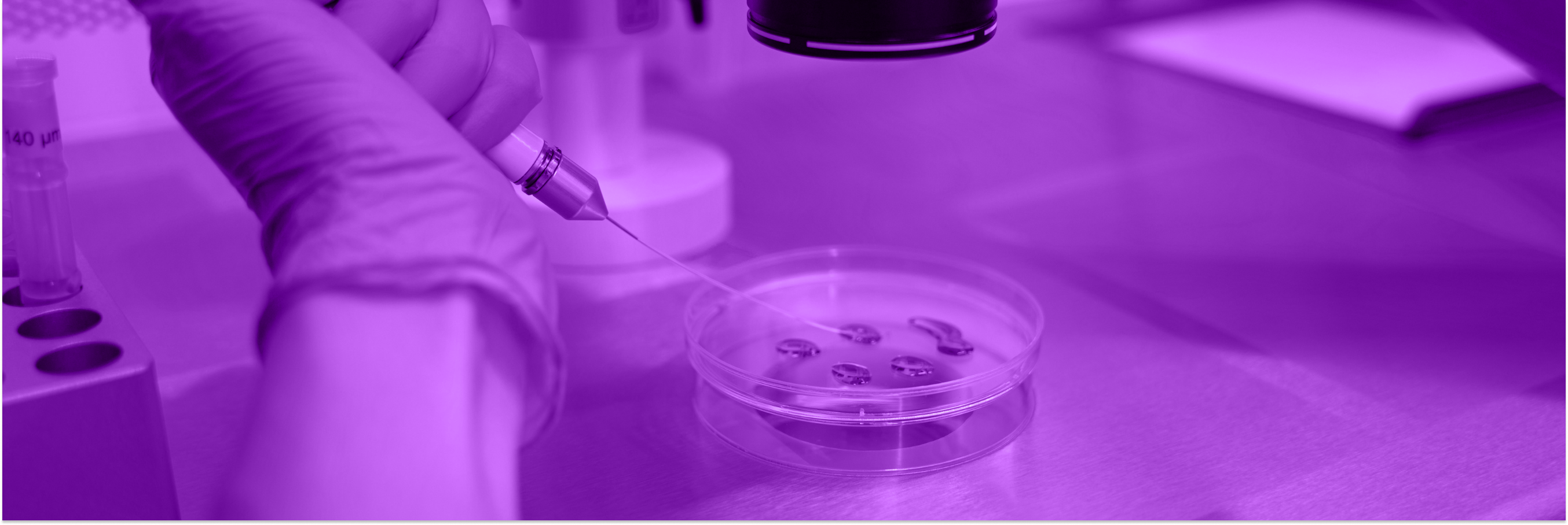 What happens at egg collection | Care Fertility