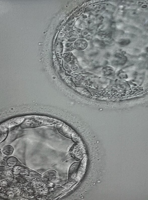 Leah and Fiona's Story | Care Fertility
